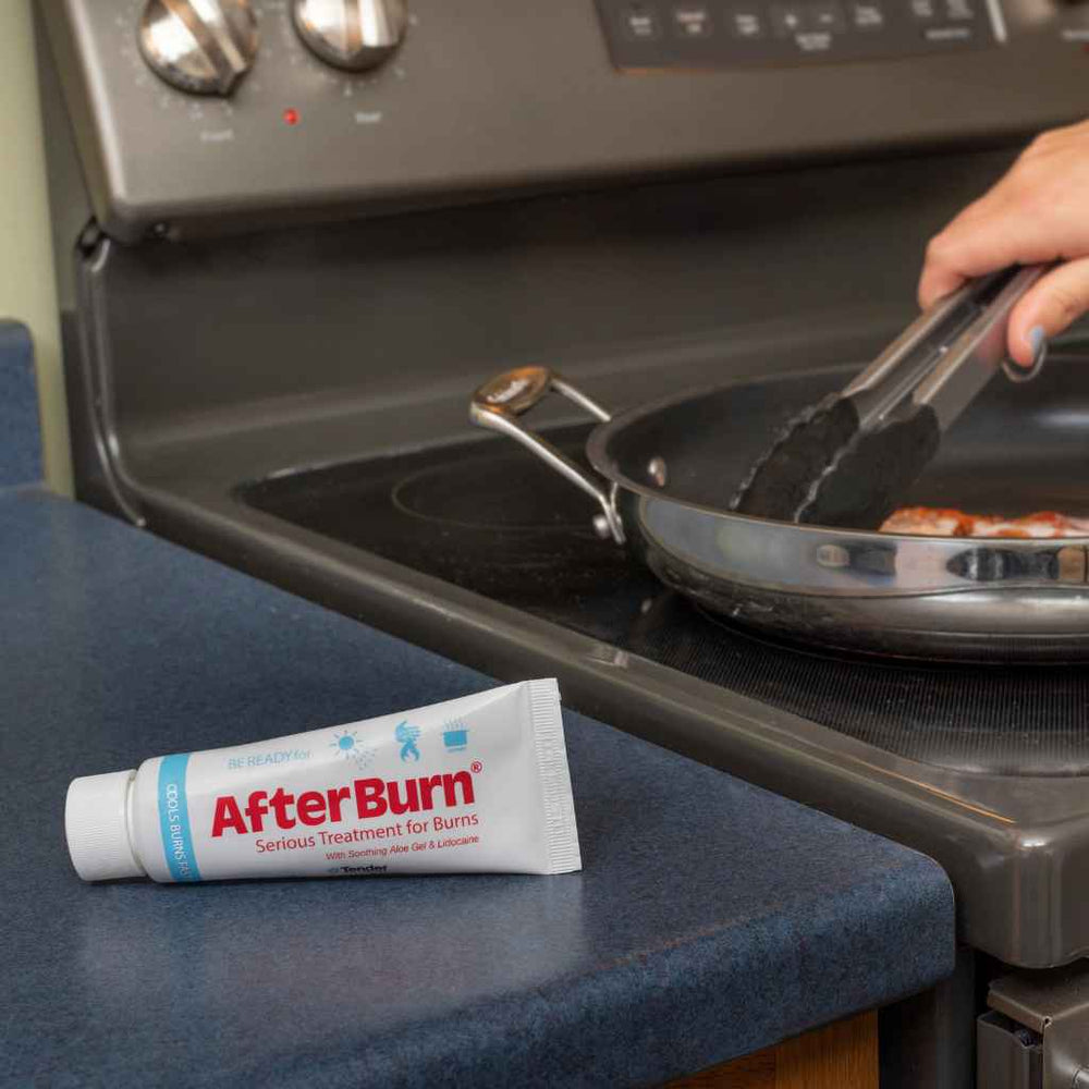 AfterBurn Burn Cream - After Bite
